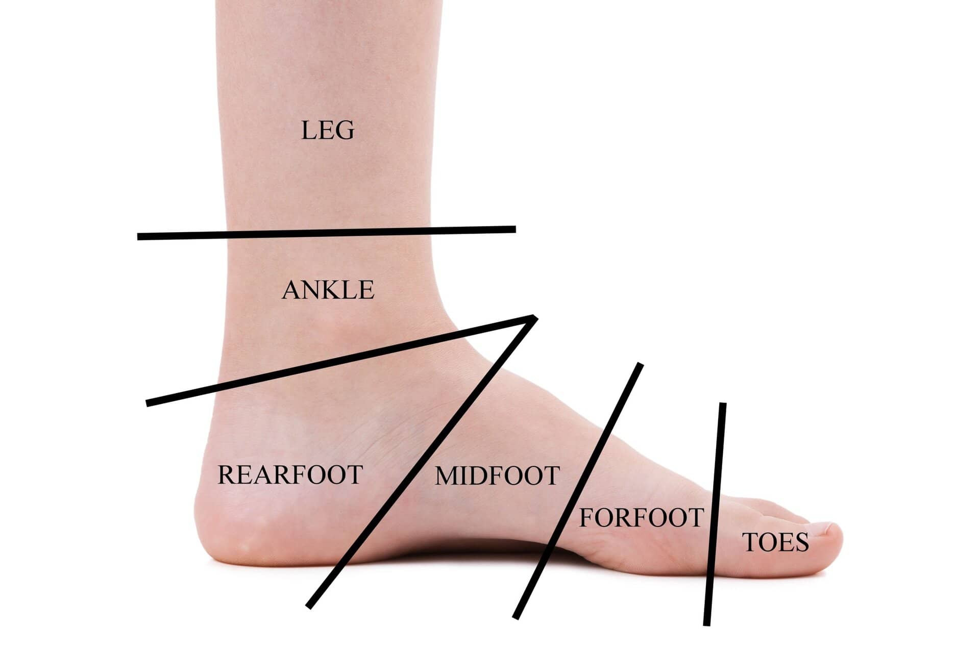 Conditions By Location - Ankle Foot and Orthotic Centre