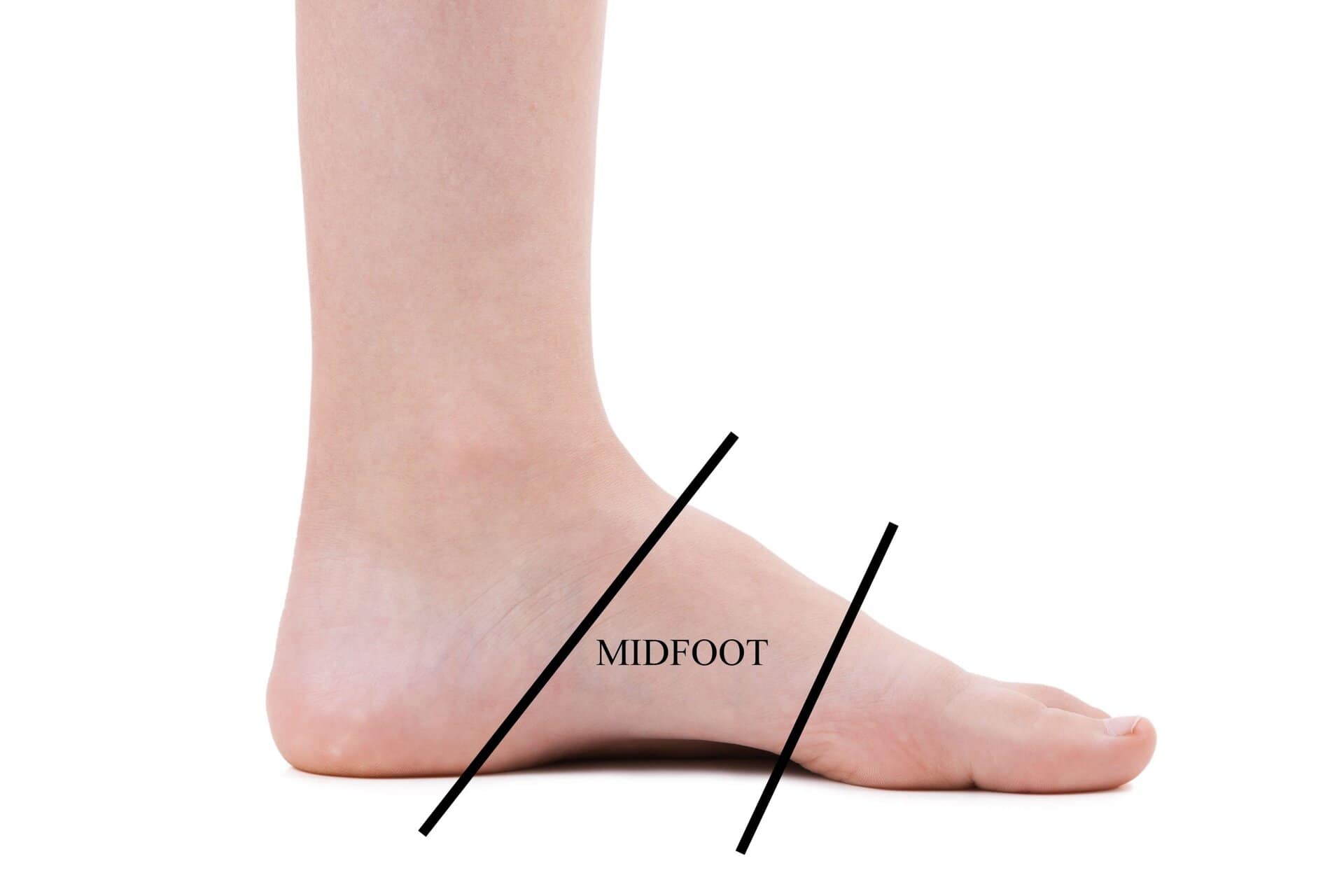 Midfoot (Arch Pain) - Ankle Foot and Orthotic Centre