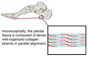Plantar fascia tear/ Strain - Ankle Foot and Orthotic Centre