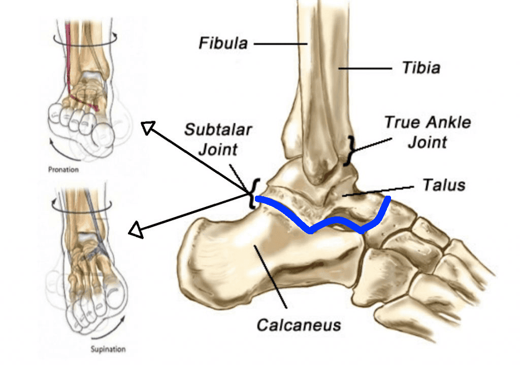 Subtalar Arthritis - Ankle Foot and Orthotic Centre