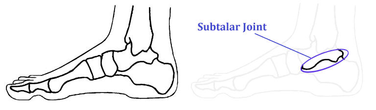 Subtalar Arthritis - Ankle Foot and Orthotic Centre