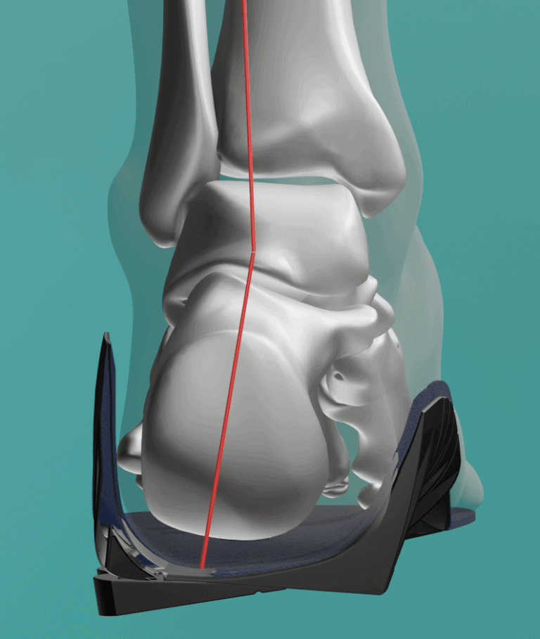 Ankle Sprains Northcote -The Foot and Ankle Centre